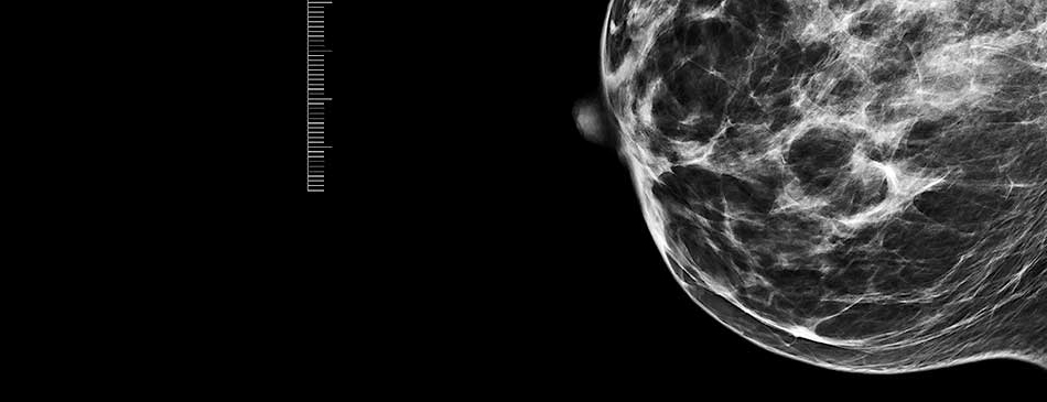 Expert Breast Surgeon in Edinburgh: Mr Dhananjay Kulkarni Edinburgh ...